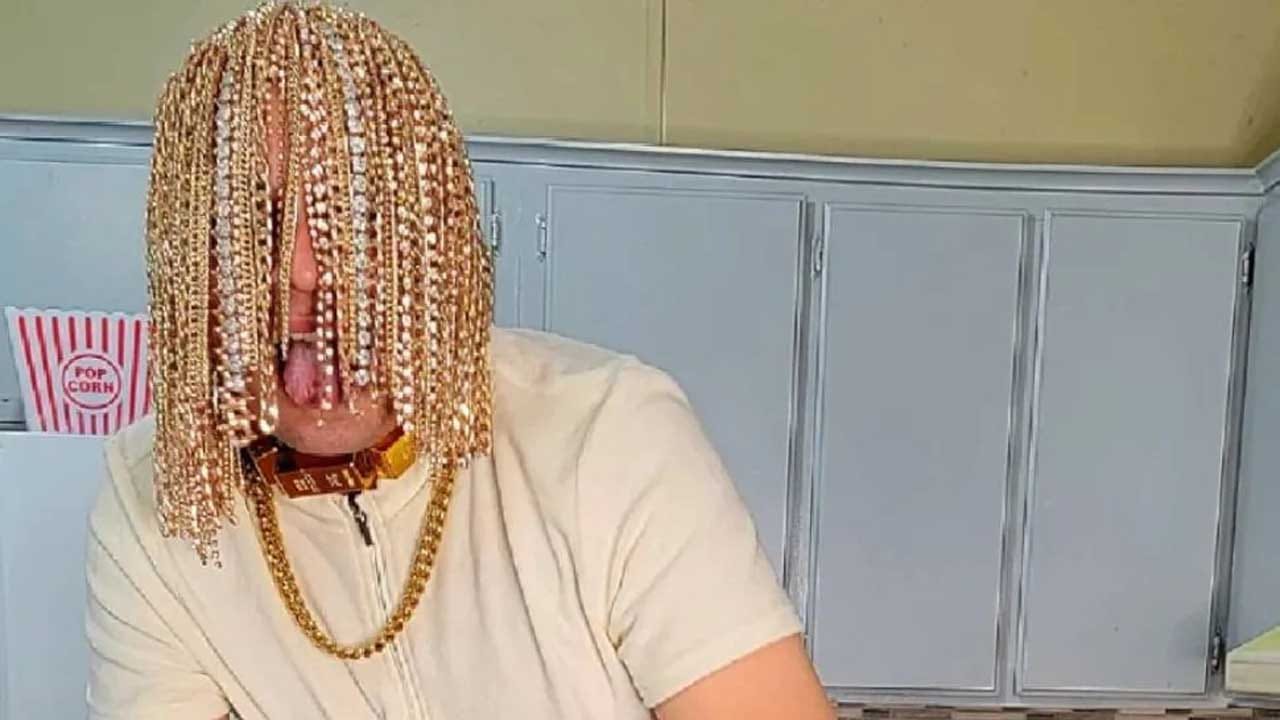 সোনার চুল! অস্ত্রোপচার করে মাথার তালুতে সোনার চেন লাগিয়ে ভাইরাল ...