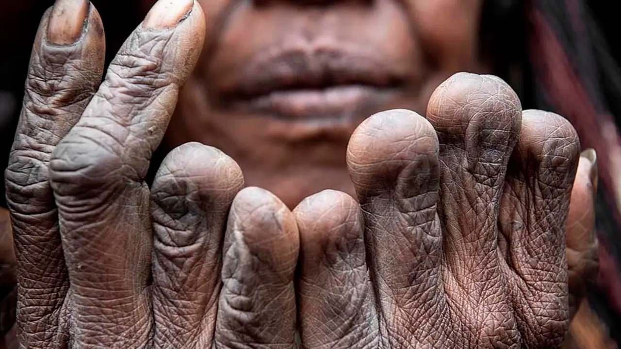 Bizarre: পরিবারে কেউ মারা গেলেই, কাটা হয় মহিলাদের আঙুল! কেন জানেন ...