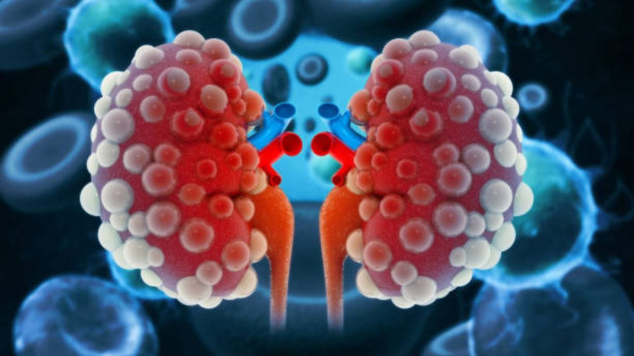 Kidney Problem: বাড়ছে কিডনির সমস্যা, এই সব লক্ষণে আগে থেকেই ...
