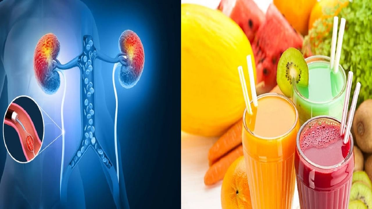 High Uric Acid Foods: এই ৫ খাবার ইউরিক অ্যাসিডের চরম শত্রু, খেলেই ... High Uric Acid Foods: এই ৫ খাবার ইউরিক অ্যাসিডের চরম শত্রু, খেলেই ...