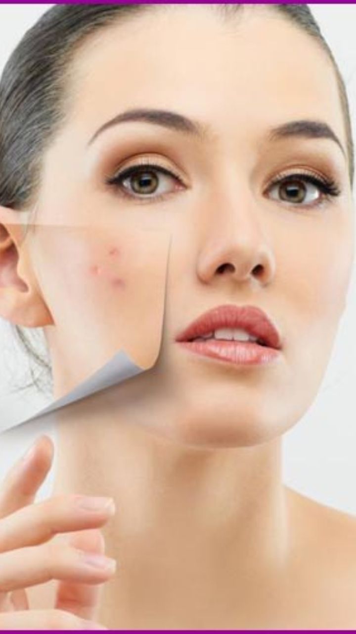 ত্বকের যম এই সব খাবার, বিপদ এড়াতে সতর্ক হন – TV9Bangla | Foods That ...