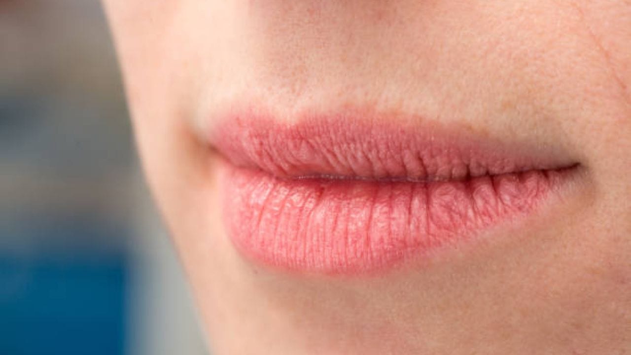 Chapped Lip: ৪০ ডিগ্রিতেও ঠোঁট ফাটছে? যত্নের অভাব নাকি তরলের ঘাটতি ...
