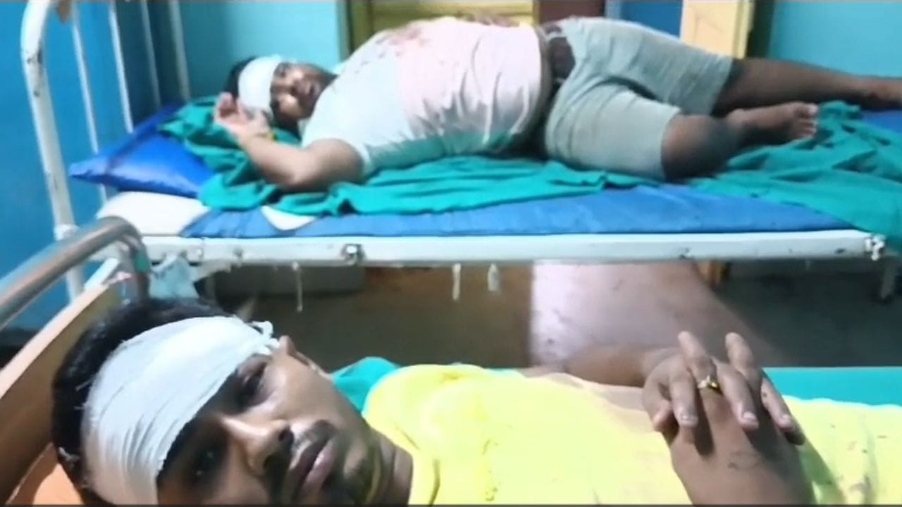 TMC: ভোট পরবর্তী হিংসার মধ্যে ব্যতিক্রমী ঘটনা! বাঁট দিয়ে মেরে তৃণমূল কর্মীরই 'মাথা ফাটাল ...