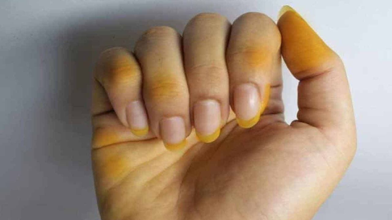 Yellow Nails: রান্নার পর নখে-আঙুলে হলুদের জেদি দাগ? সাবানের বদলে এই ৫ ...