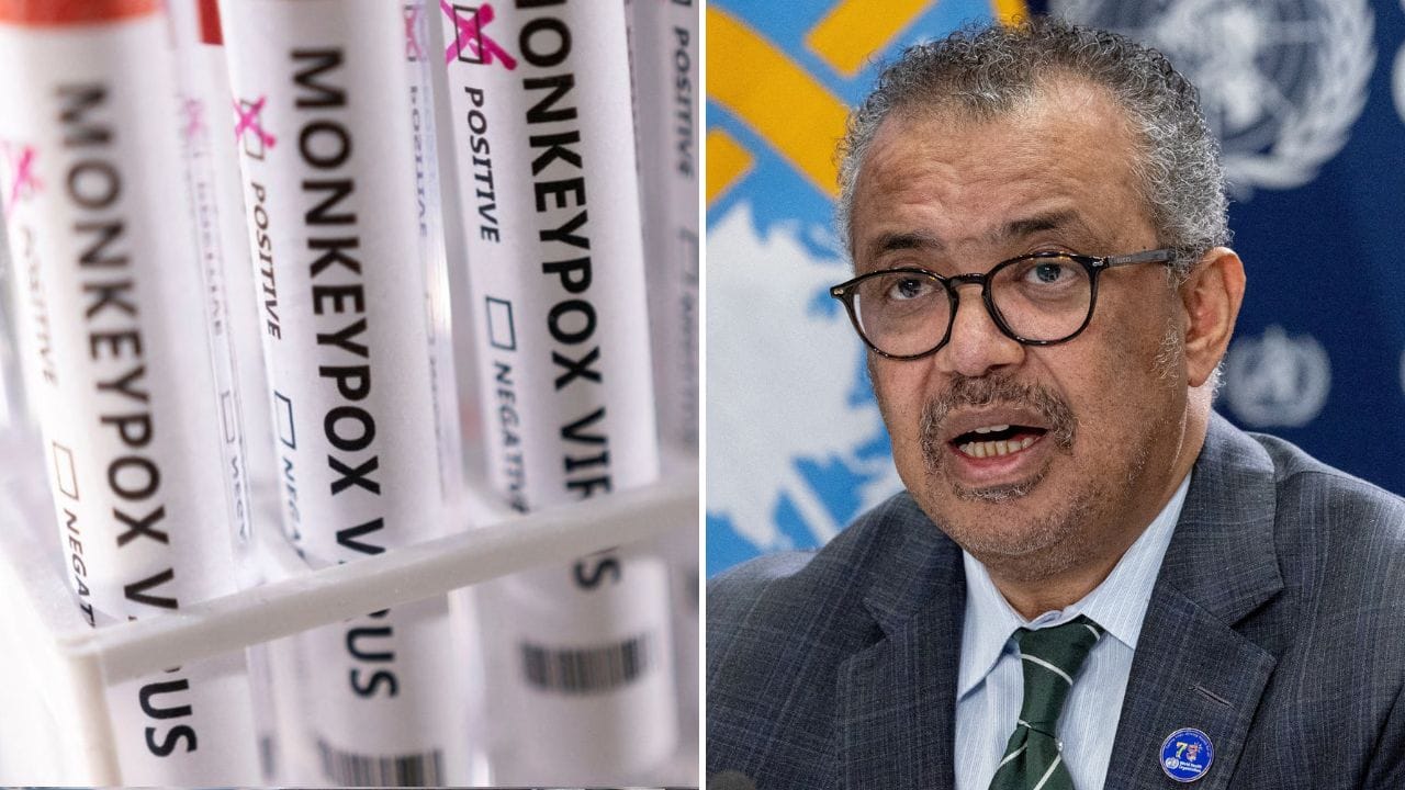 Monkey Pox Outbreak: মাঙ্কি পক্স-এর বাড়বাড়ন্ত, 'গ্লোবাল হেলথ ...