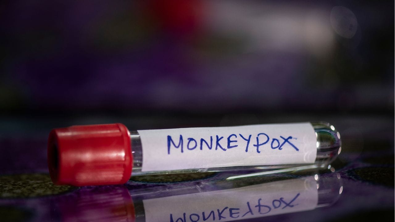 Monkeypox clade 1: প্রথমবার ভারতে মাঙ্কিপক্সের ক্লাড ১ স্ট্রেনের হদিশ ...