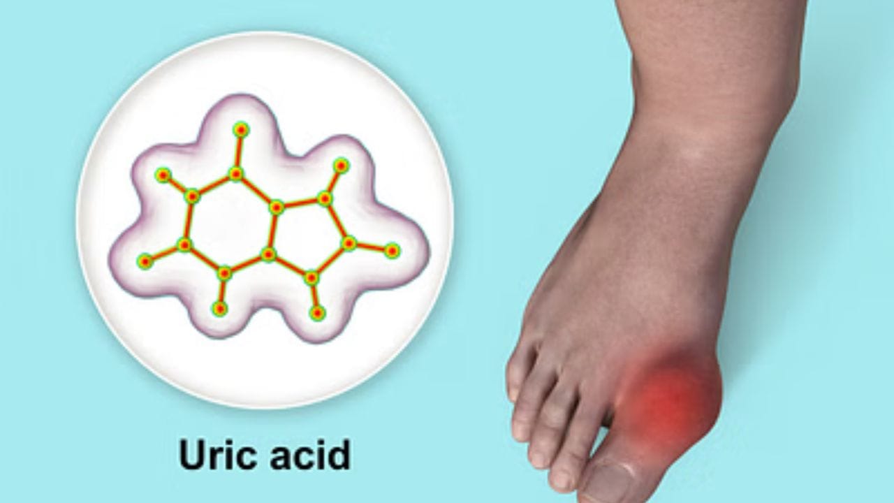Uric Acid: রক্তে ইউরিক অ্যাসিড বৃদ্ধি পায়নি তো? রক্ত পরীক্ষা না করেও ...