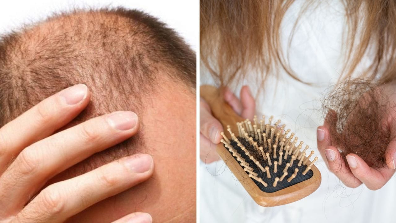 Hair Fall Reason: মেয়েদের টাক কেন হয় না? জানুন ডাক্তারের যুক্তি ...